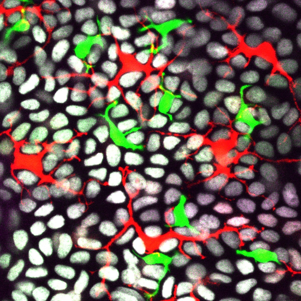 Understanding the skin’s defense system – IQ